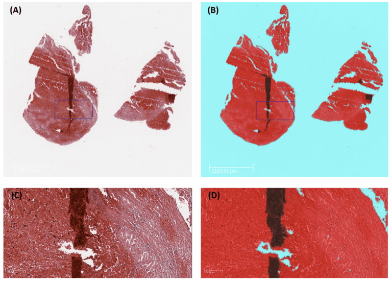 Big Medical Image Preprocessing With Apache Beam | A Step-by-Step Guide